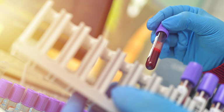 The importance of renal screening - Busamed